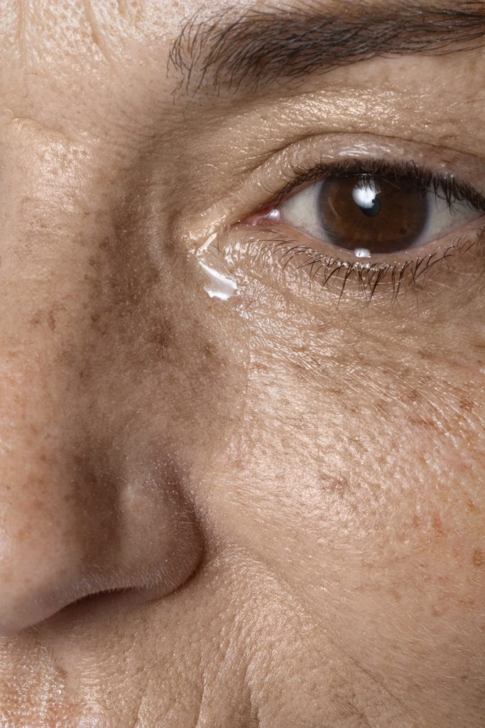 Skin Texture Issues - Life Conceptual