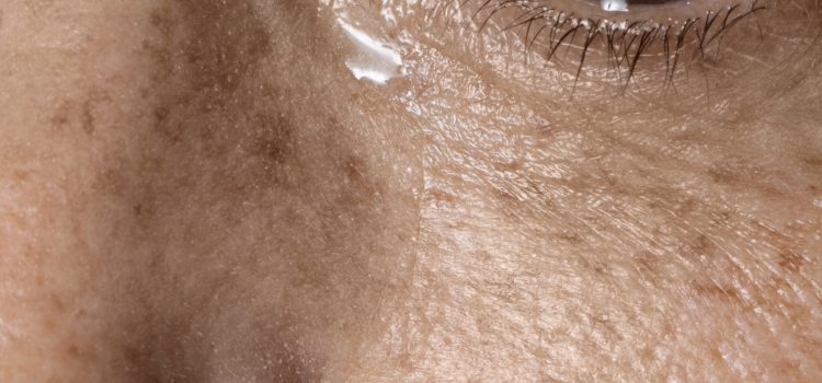 Skin Texture Issues - Life Conceptual