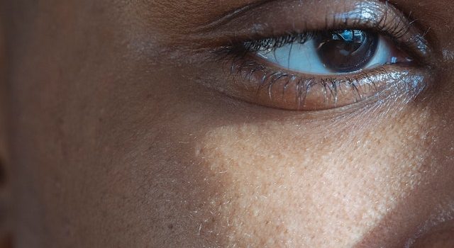 Say Goodbye to Blackheads: Understanding the Causes and Solutions ... Say Goodbye to Blackheads: Understanding the Causes and Solutions ...
