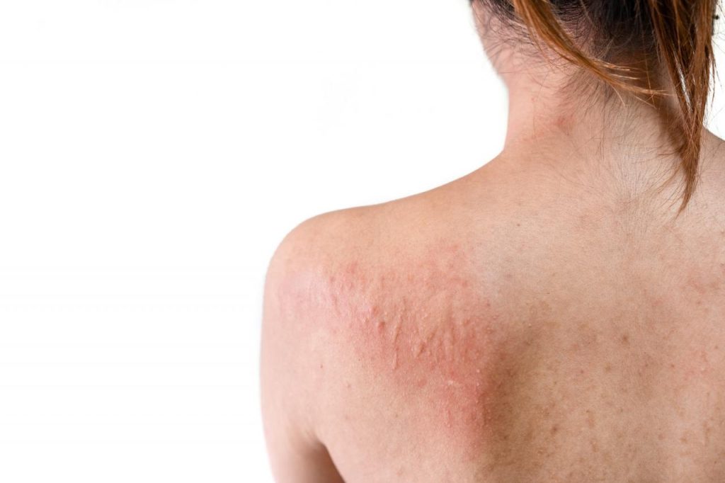 Spot the Cause: Uncovering 10 Common Skin Redness Triggers with Dr ... Spot the Cause: Uncovering 10 Common Skin Redness Triggers with Dr ...
