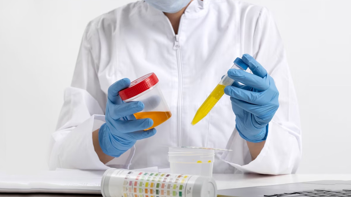 Unraveling Cloudy Urine: Dr. Michael S. Cookson Demystifies Causes and ...