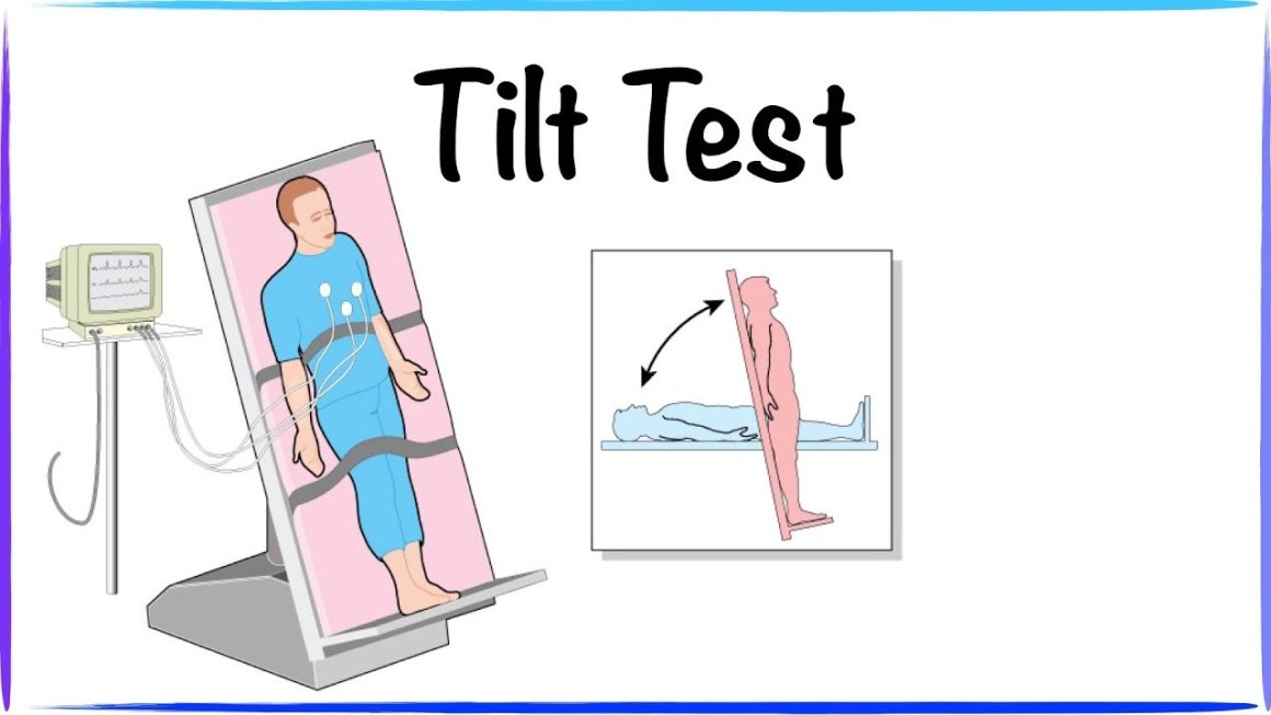Understanding POTS: How to Find and Treat Dizziness