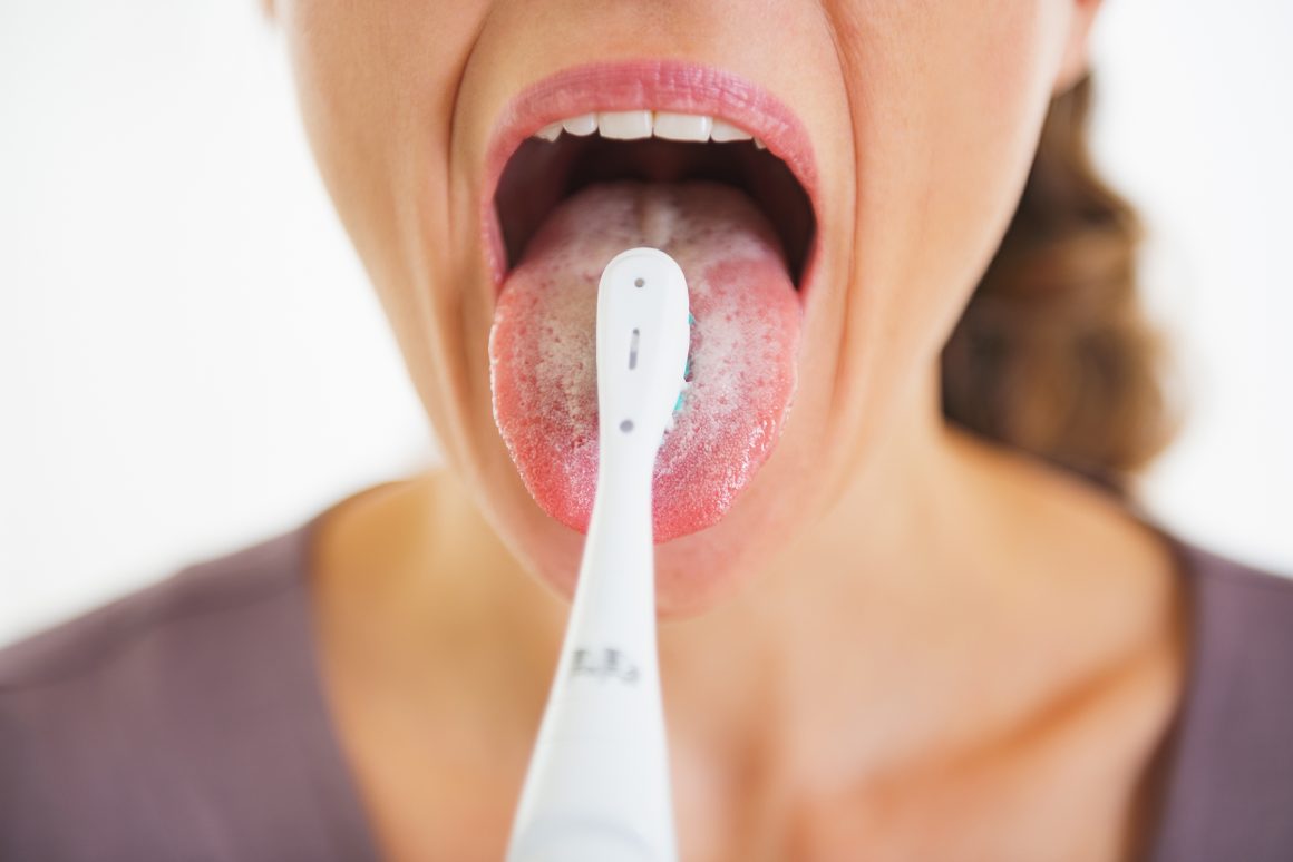 Shades of Wellness: Understanding Tongue Color Variations